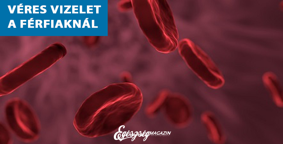 EgeszsegMagazin.hu - Véres vizelet férfiaknál - ez a 9 leggyakoribb ok